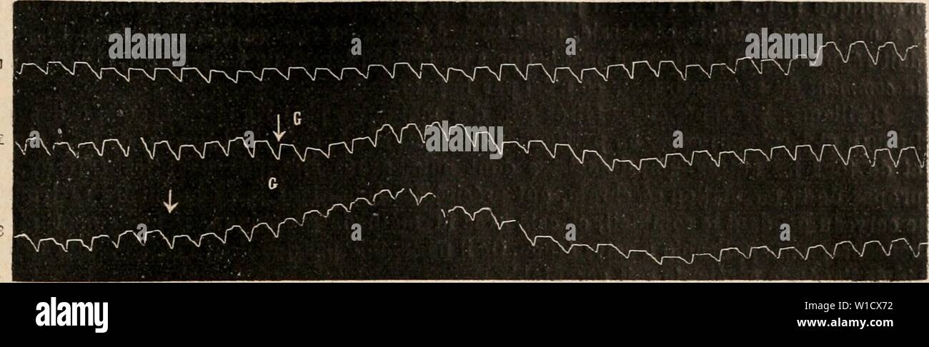 Rougit hi-res stock photography and images - Alamy