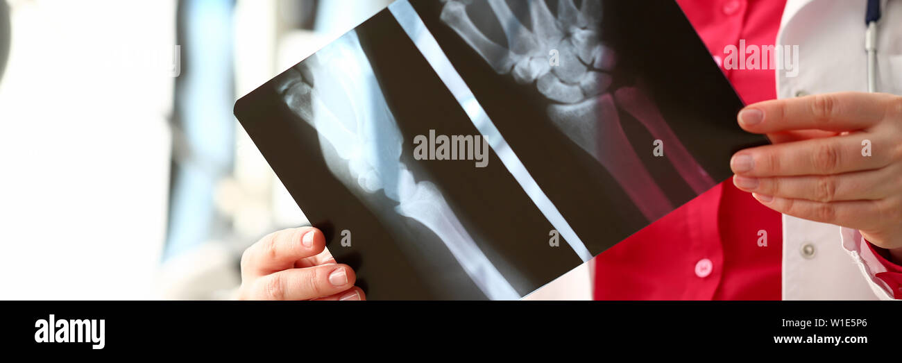 Female radiologist hold in hand xray film Stock Photo - Alamy
