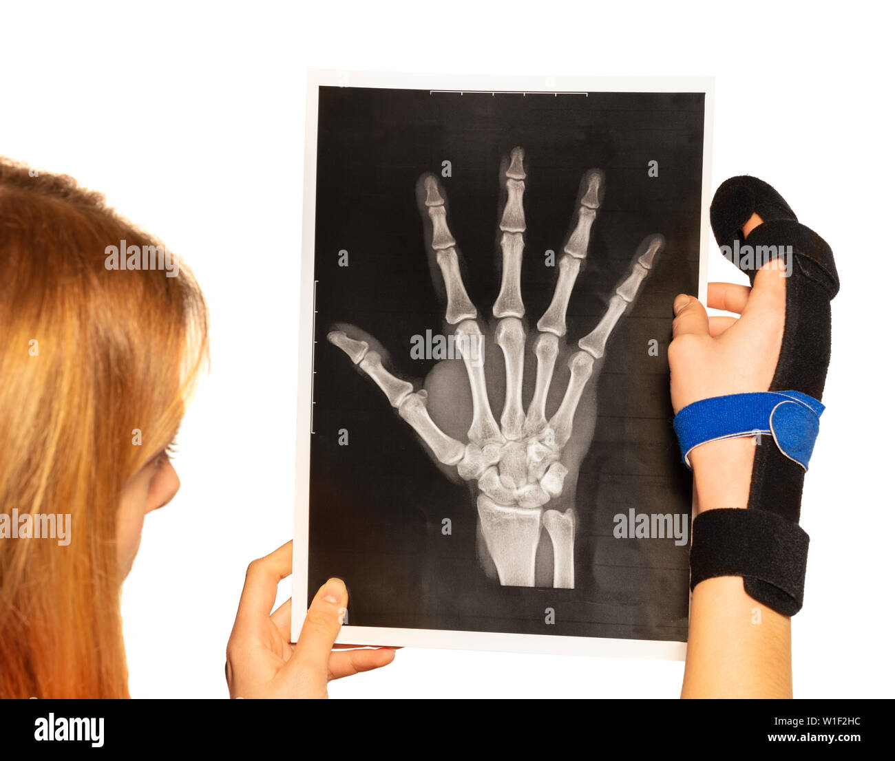 Finger sling hi-res stock photography and images - Alamy