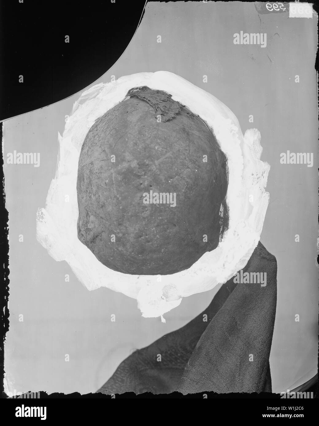 Top of skull Black and White Stock Photos & Images - Alamy