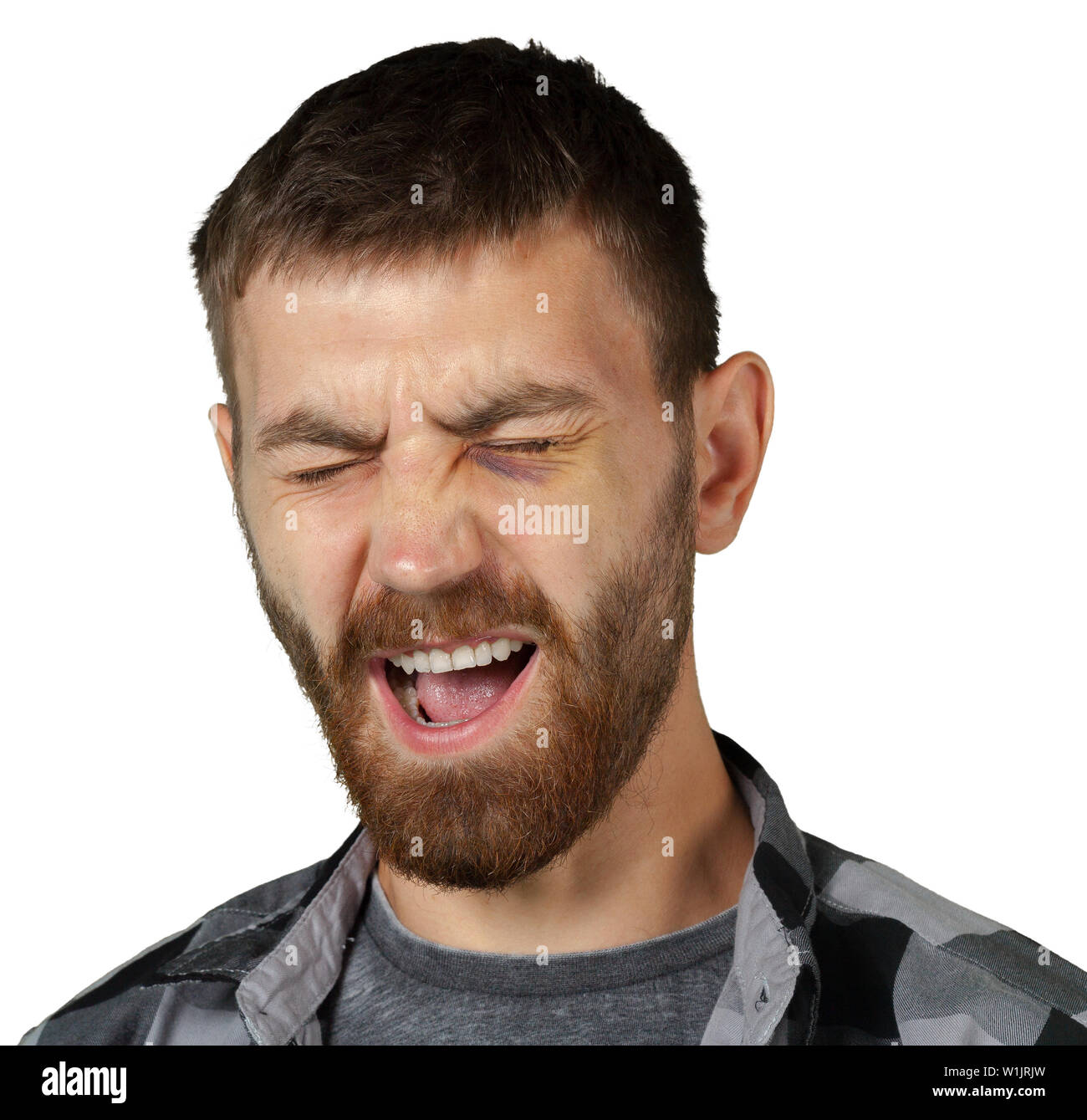 Boxer injured eye hi-res stock photography and images - Alamy