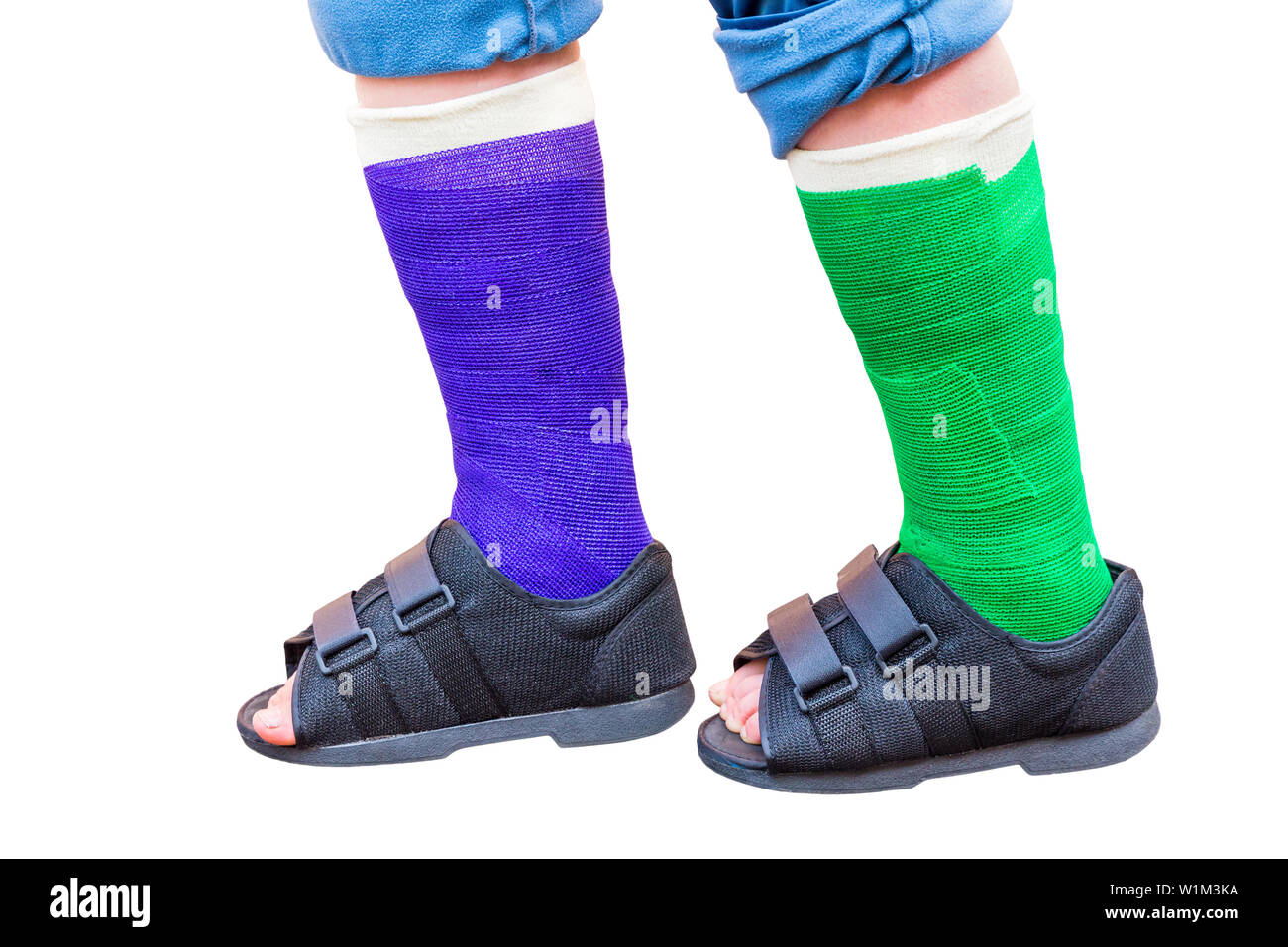 Two standing colored gypsum legs with shoes isolated on white ...