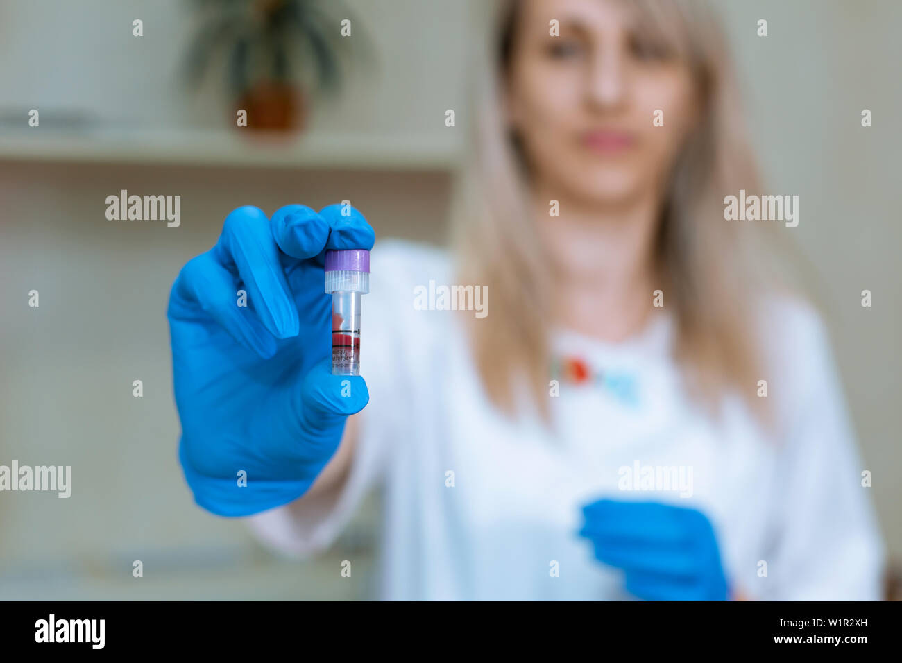 A female blonde lab technician takes a blood sample with blue gloves ...