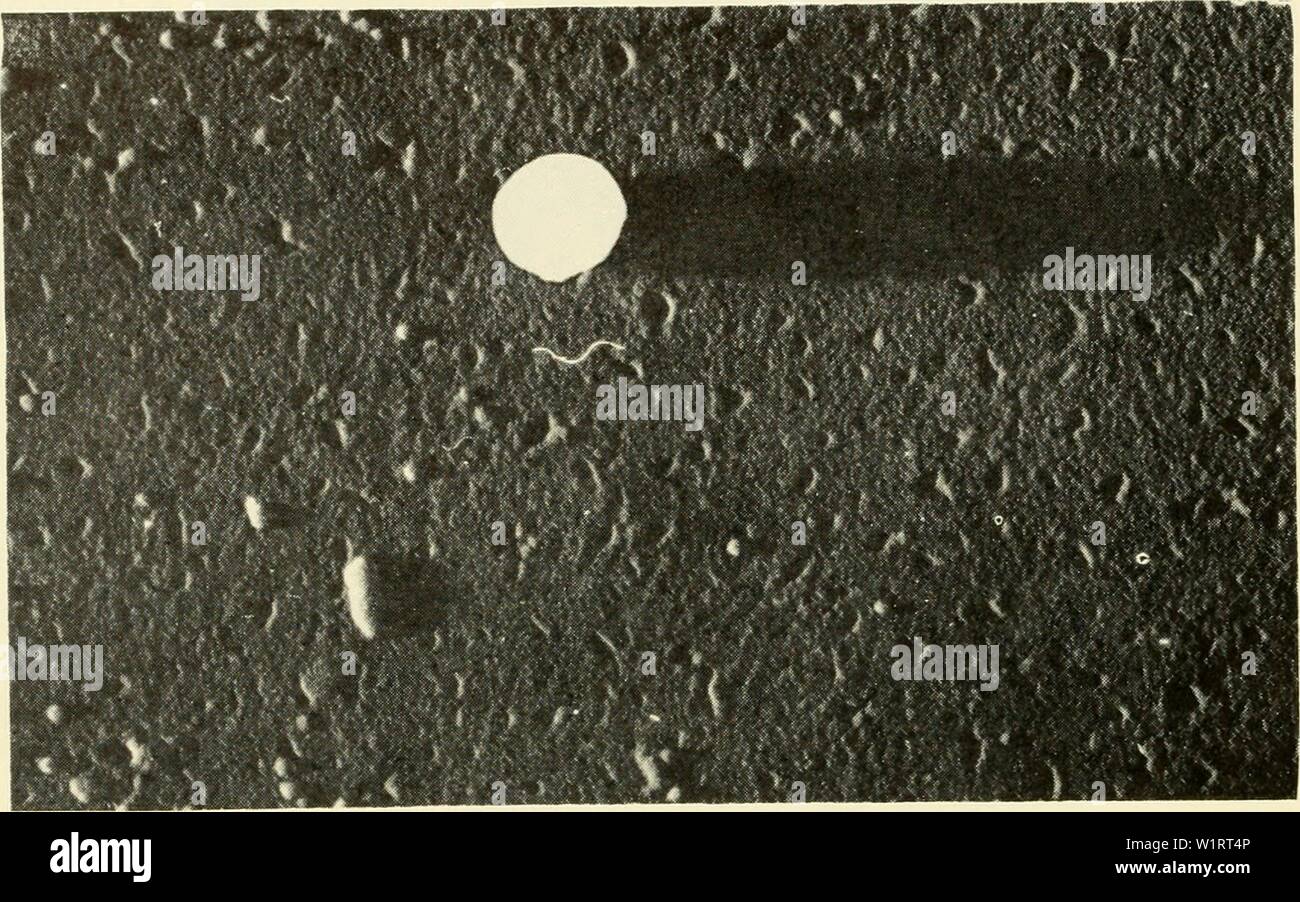 Electron micrograph of ribosomes hi-res stock photography and images ...