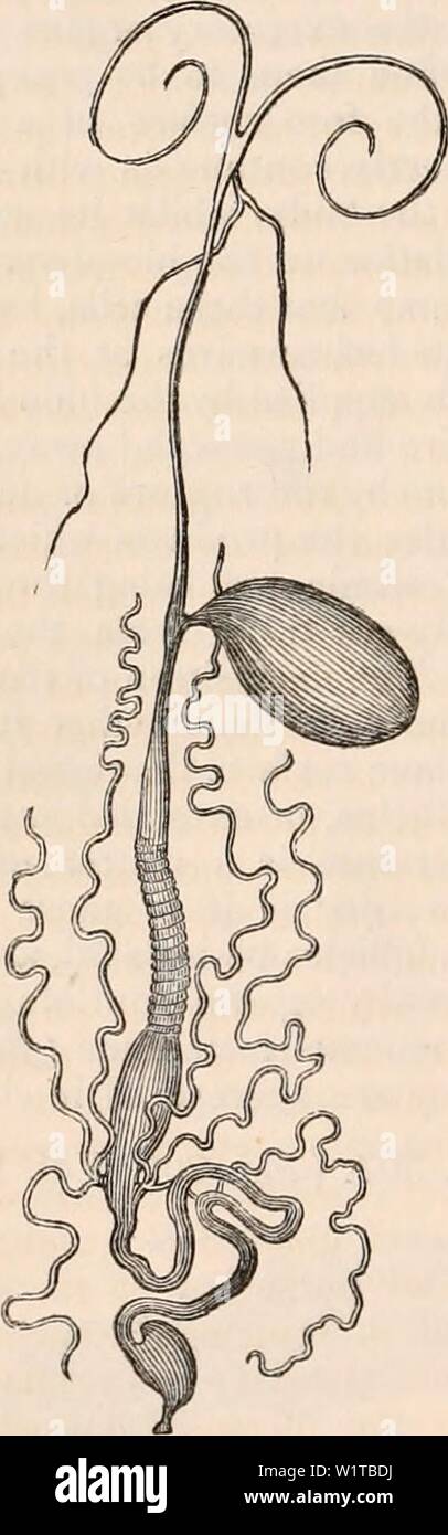 Image of kidney mass hi-res stock photography and images - Alamy