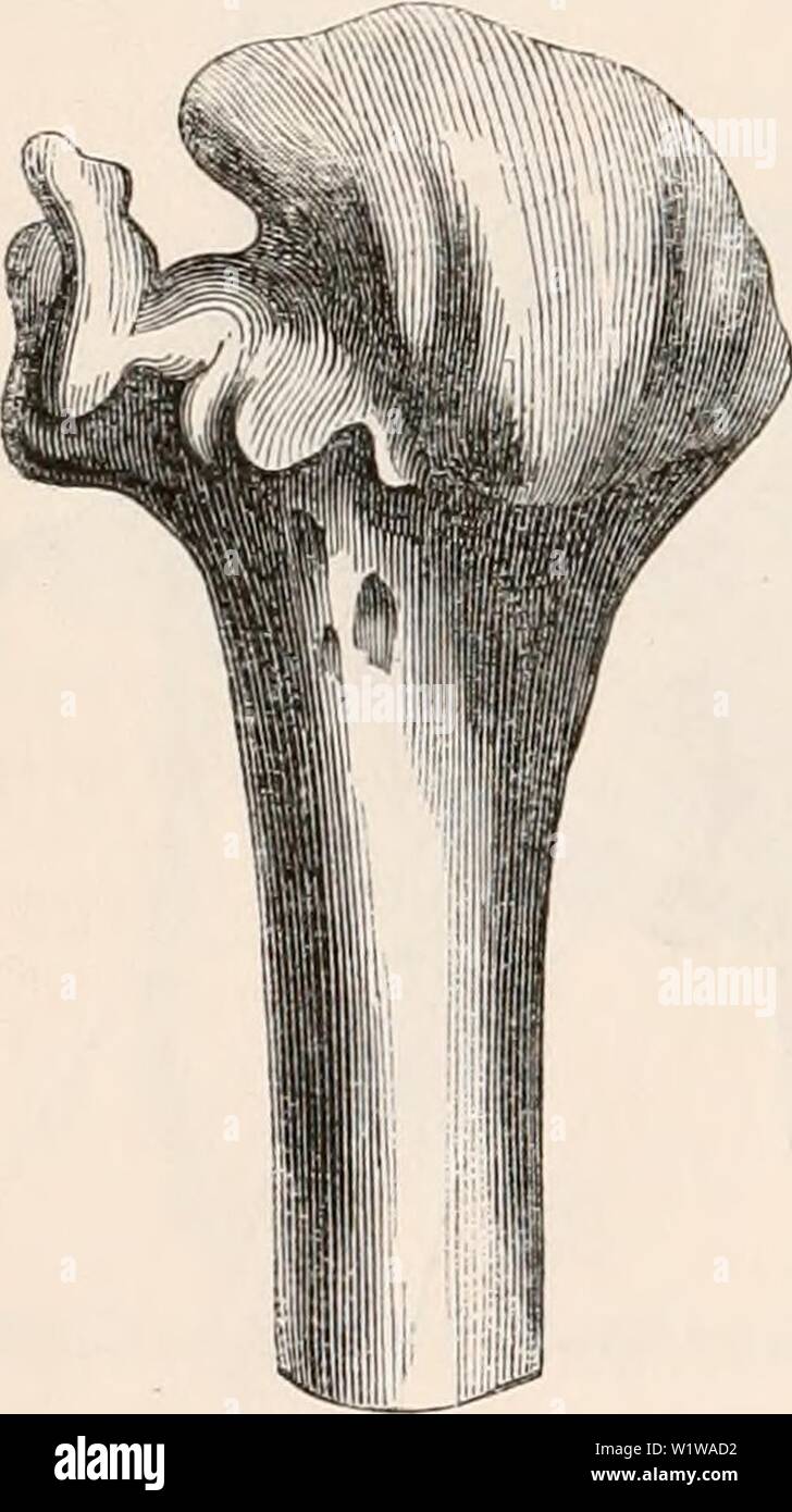 Left shoulder anatomy hi-res stock photography and images - Alamy