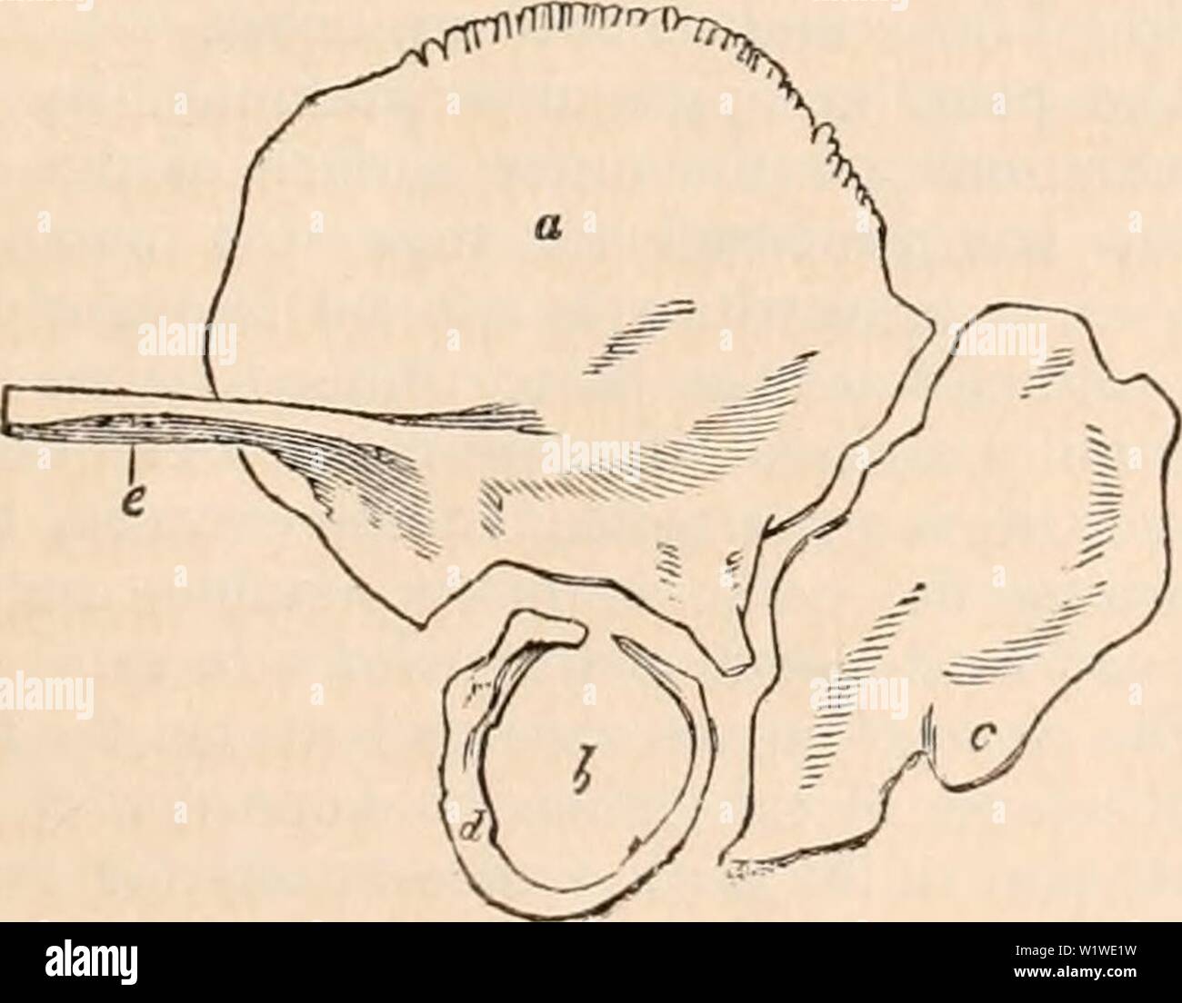 Posterior fossa hi-res stock photography and images - Alamy