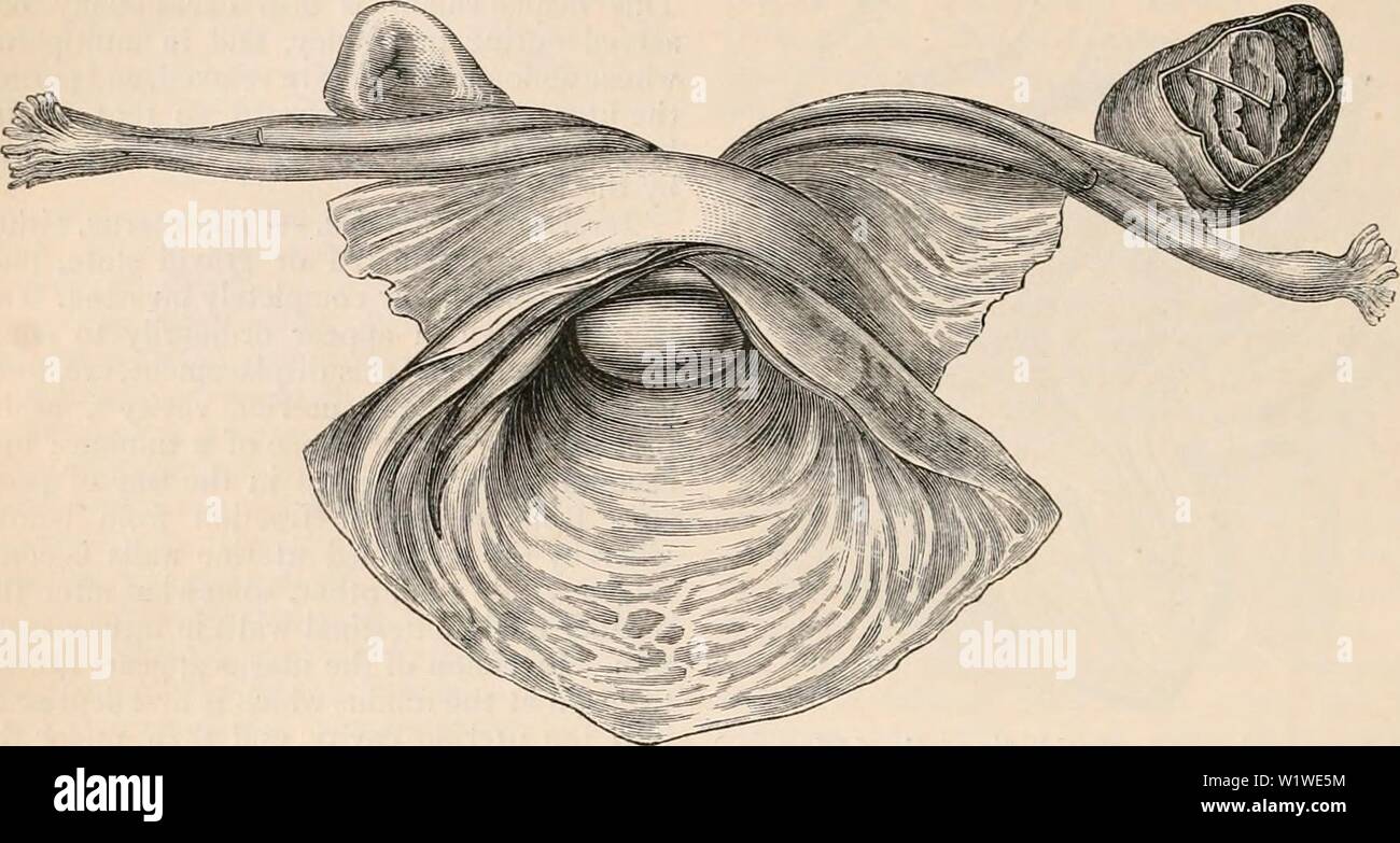 Fundus of uterus hi-res stock photography and images - Alamy