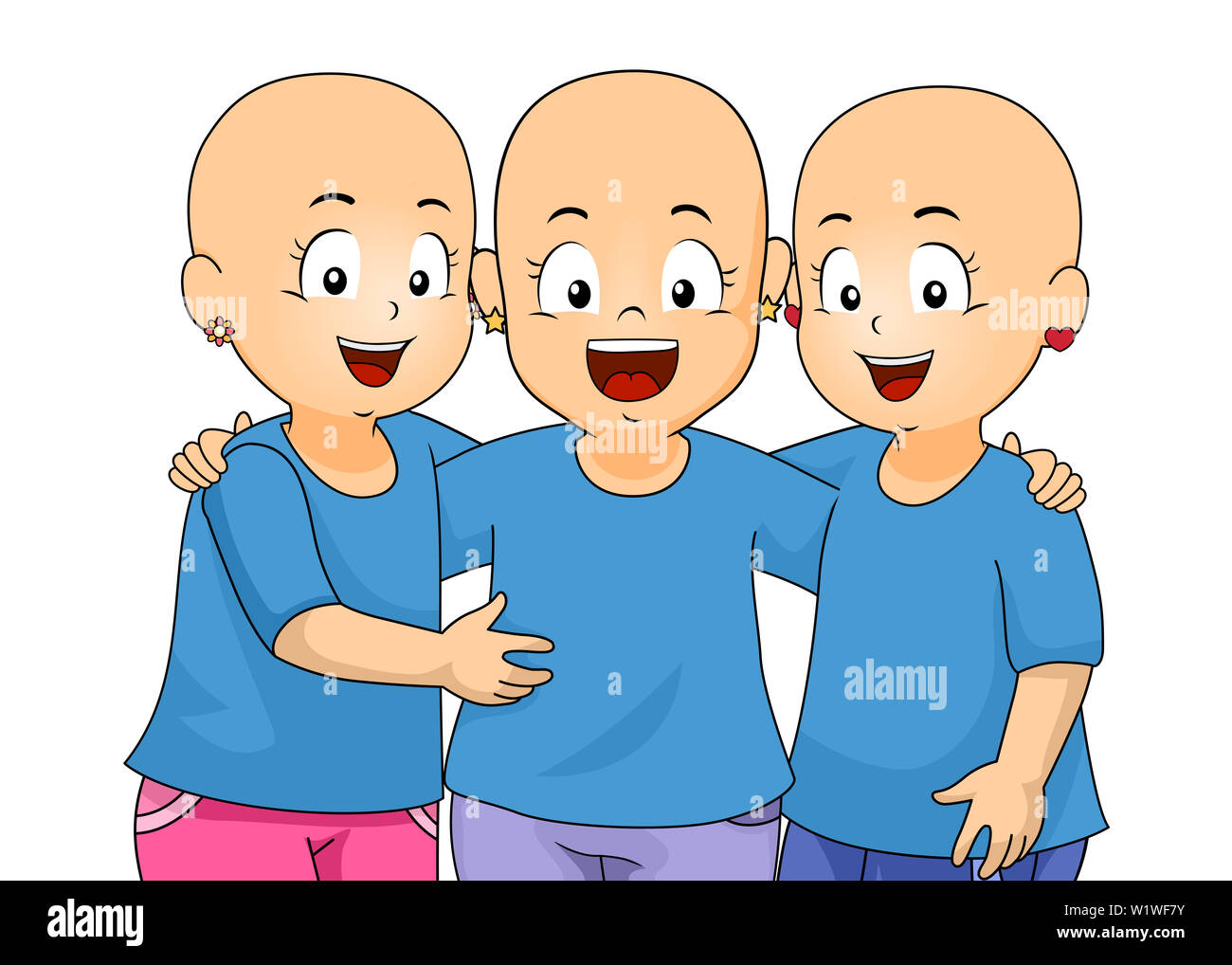 Illustration of Bald Kids Girls with Alopecia Wearing Same Blue Shirt ...
