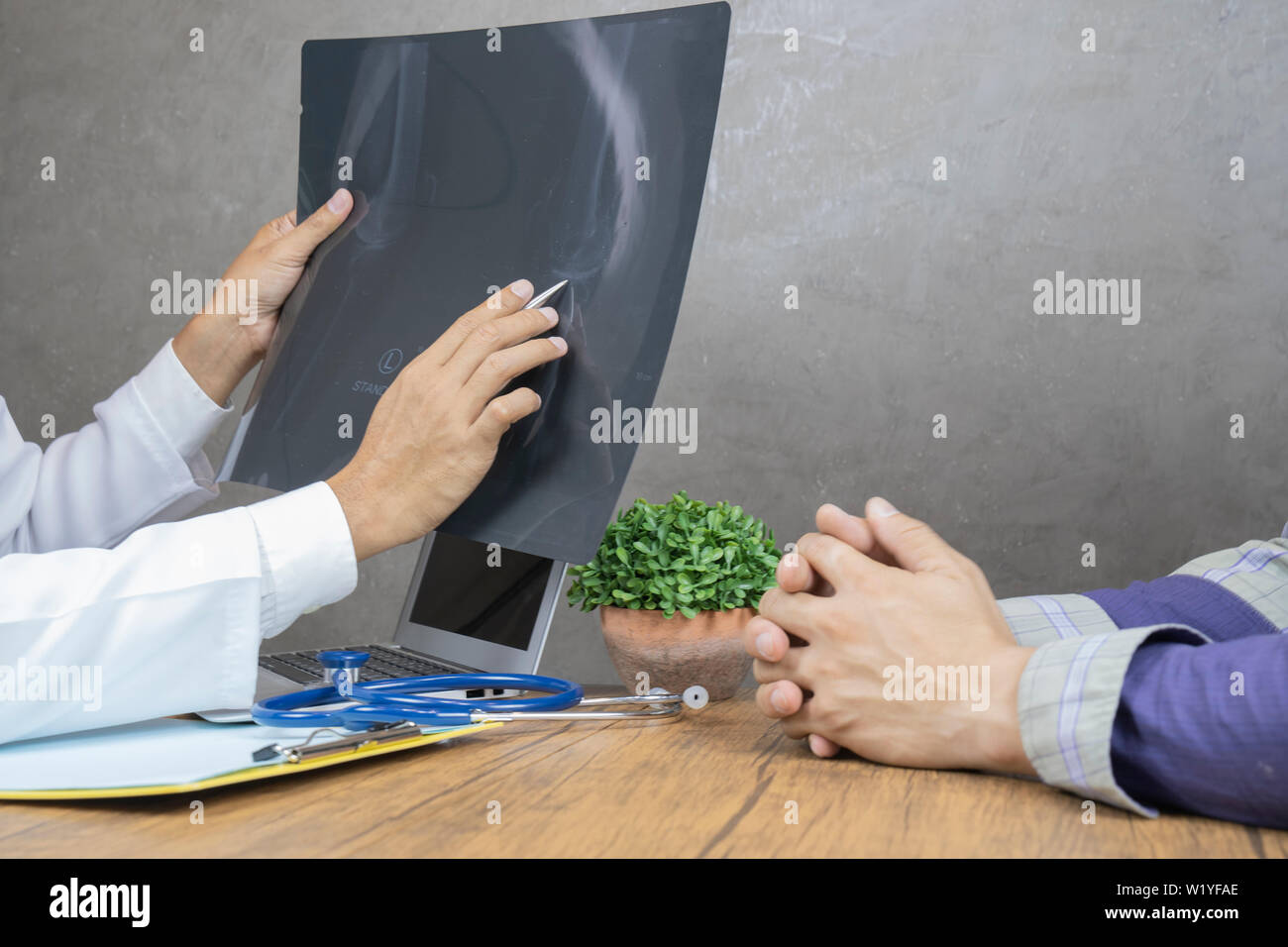 Doctor holding chest x ray hi-res stock photography and images - Alamy