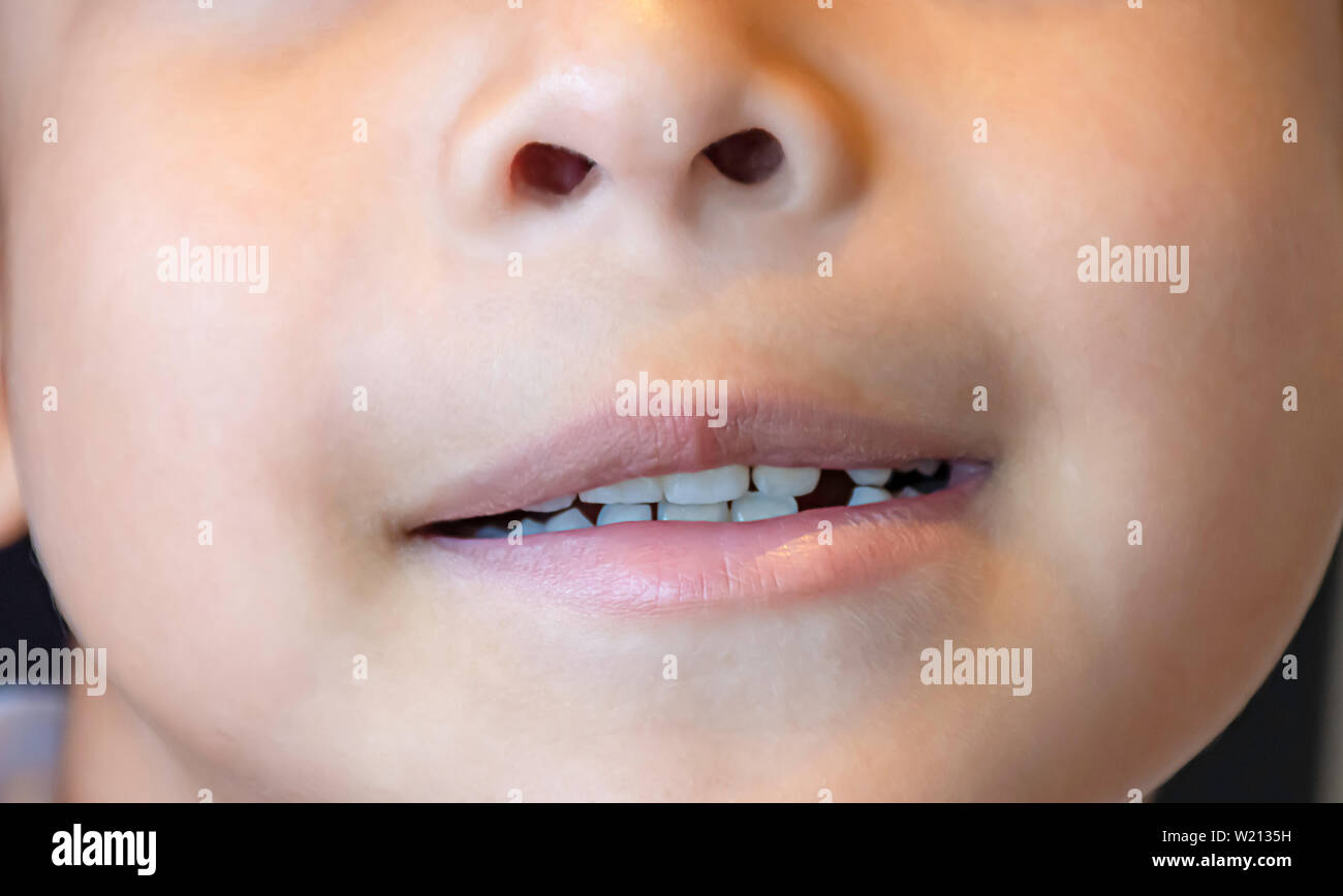 Baby teeth are just dropped in the mouth Stock Photo - Alamy