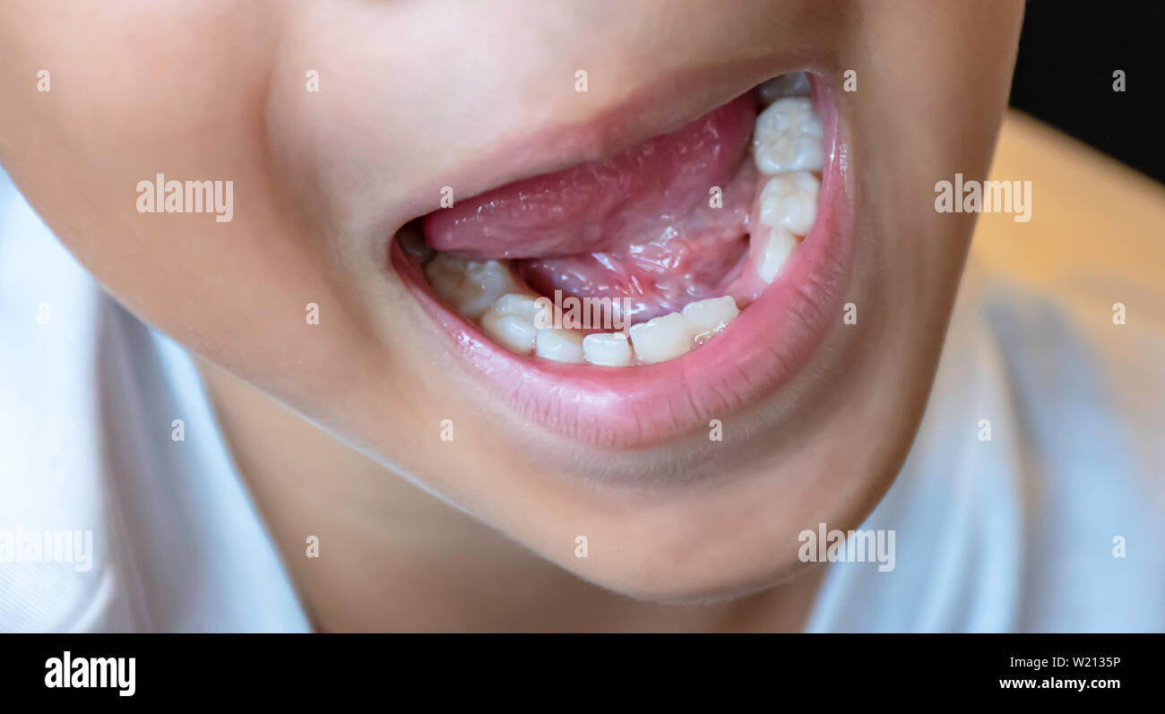 Baby teeth are just dropped in the mouth Stock Photo - Alamy