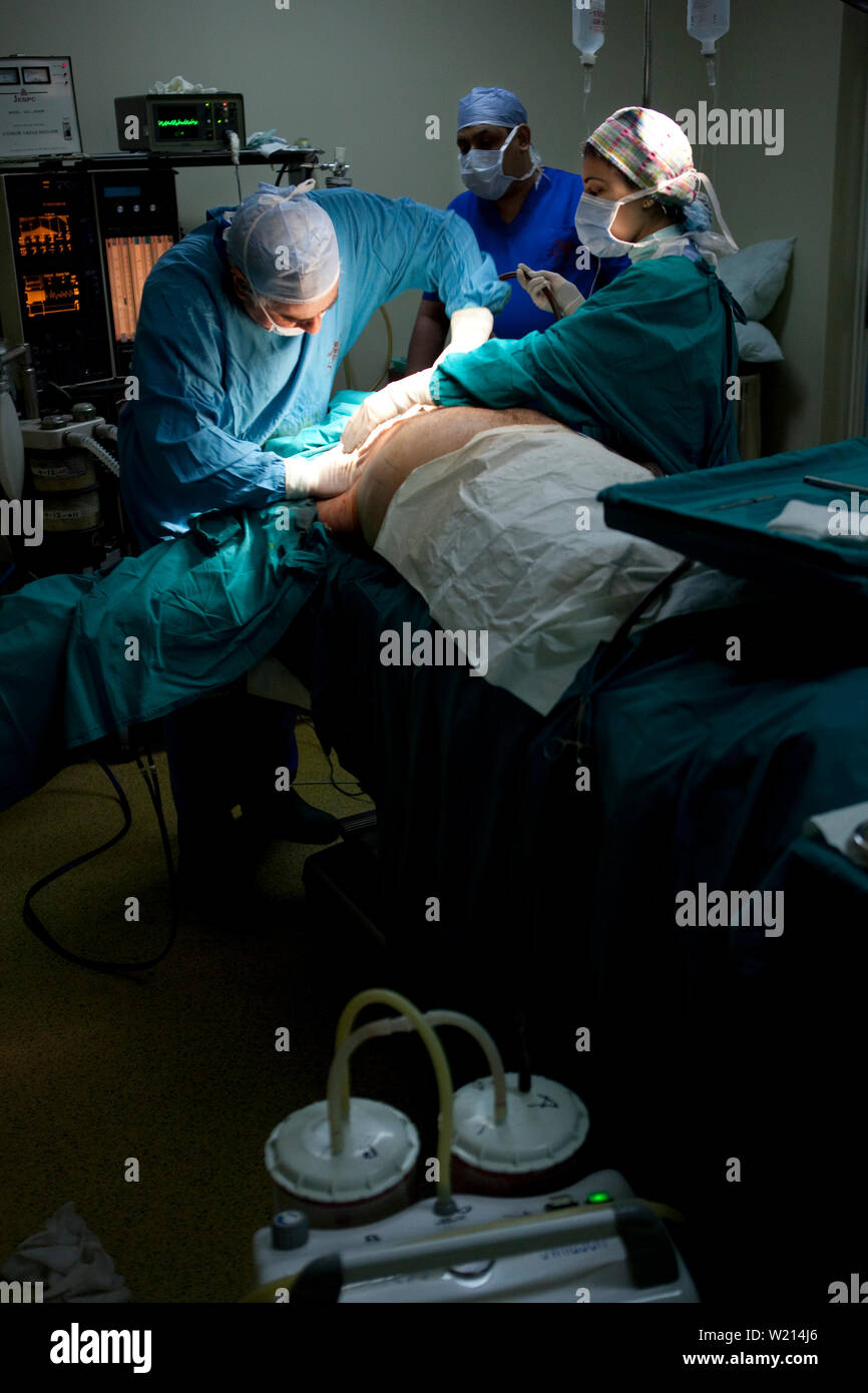 Human Abdomen High Resolution Stock Photography and Images - Alamy