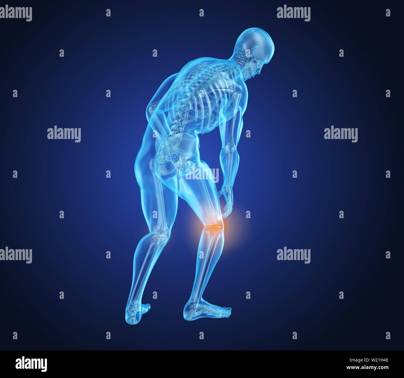 Knee pain Attack, man suffering from spinal knee. 3D illustration Stock ...