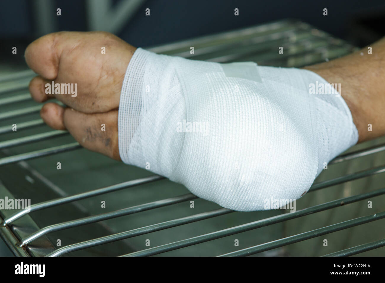 Diabetic foot infection hi-res stock photography and images - Alamy