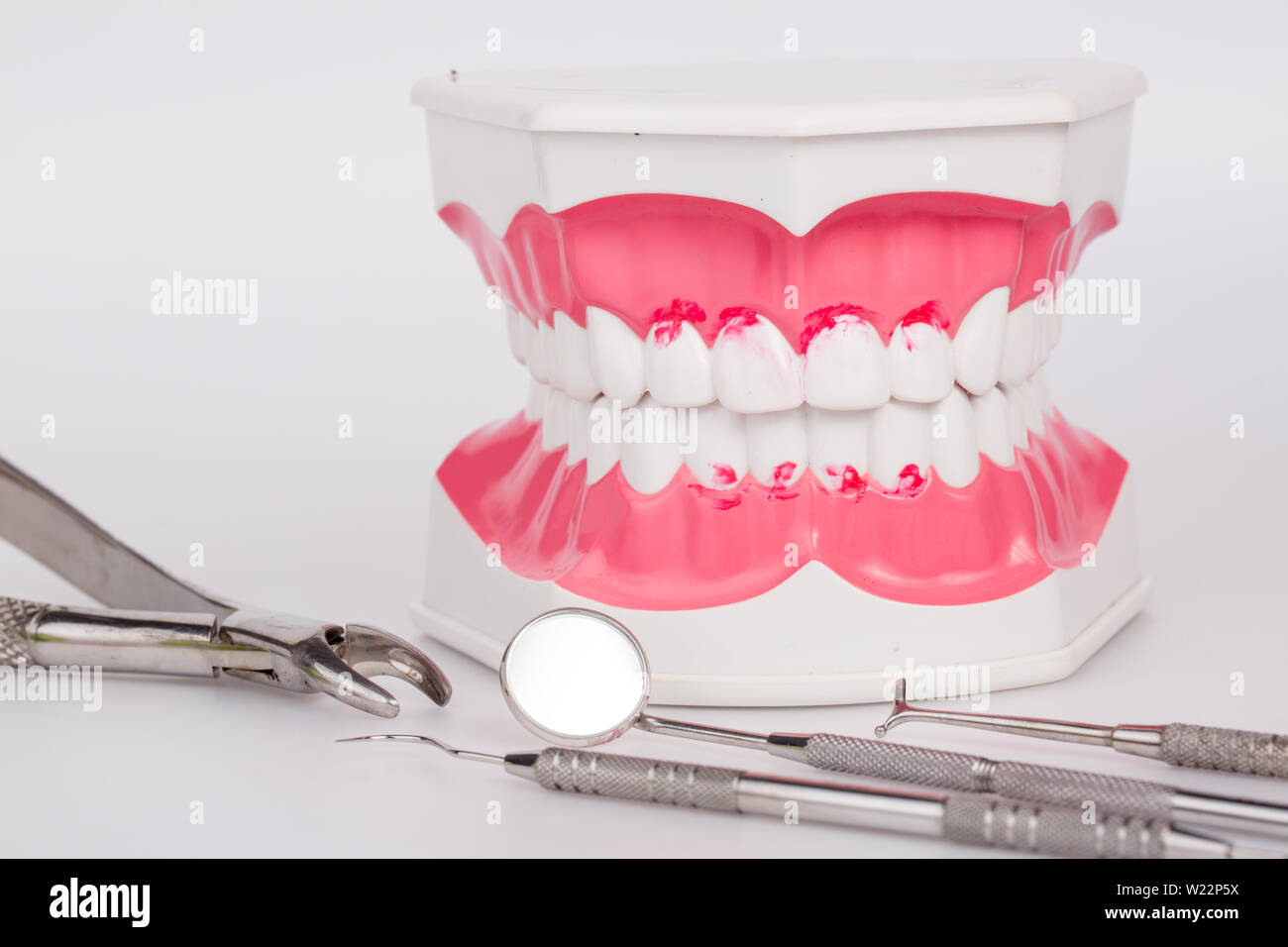 Orthodontic instruments hi-res stock photography and images - Alamy