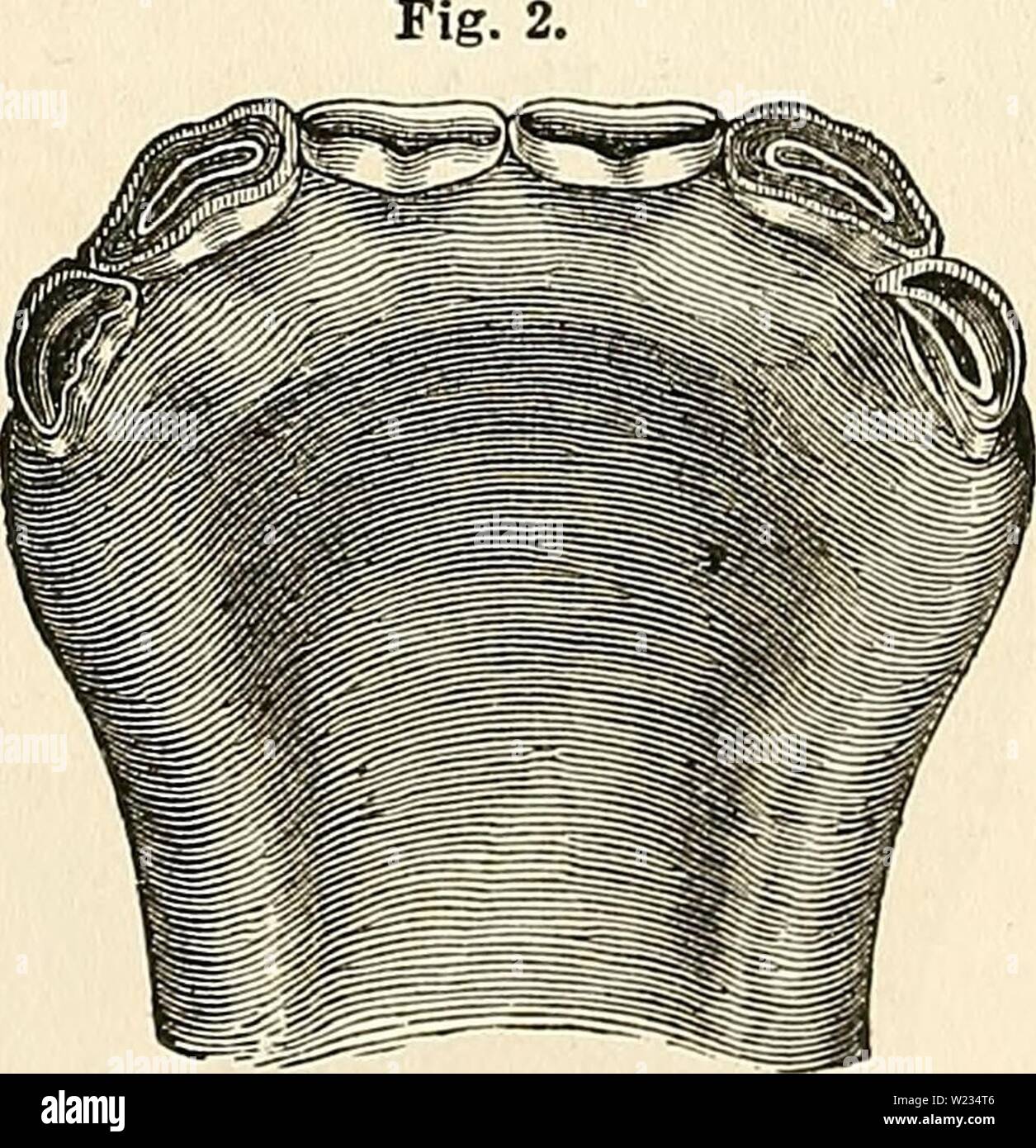 Temporary teeth hi-res stock photography and images - Alamy