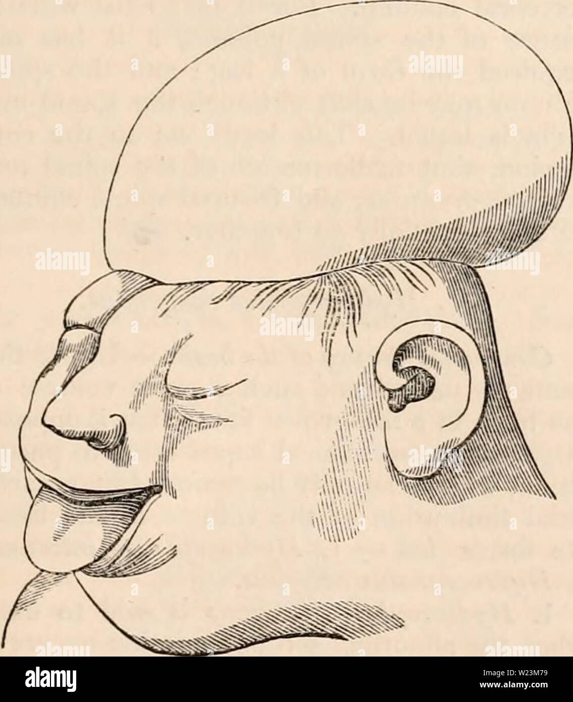 Acrania hi-res stock photography and images - Alamy