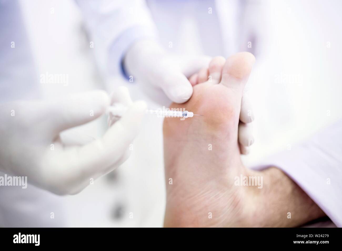Dermatologist injecting botox on sole of feet to treat excessive ...