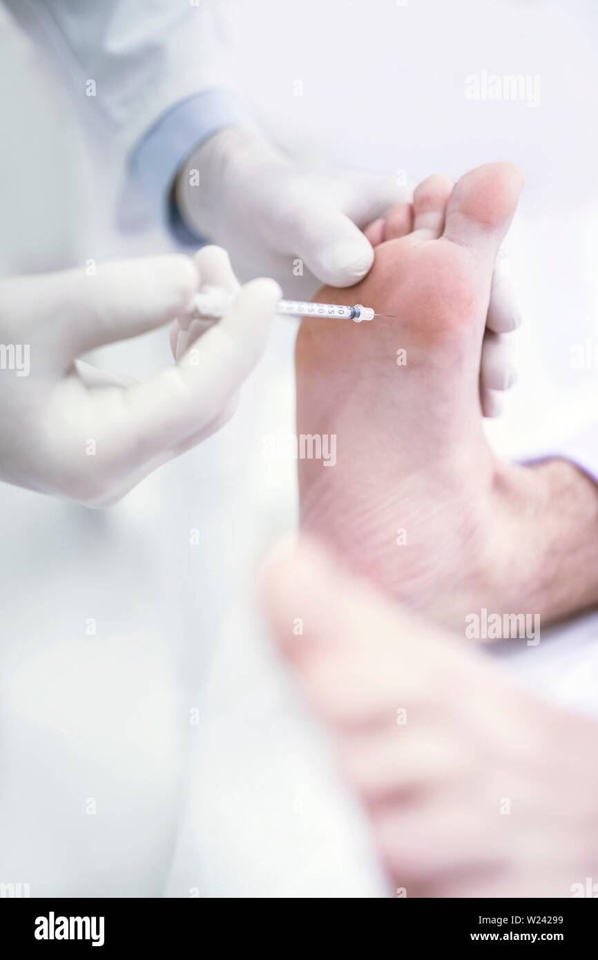 Sweating feet hi-res stock photography and images - Alamy