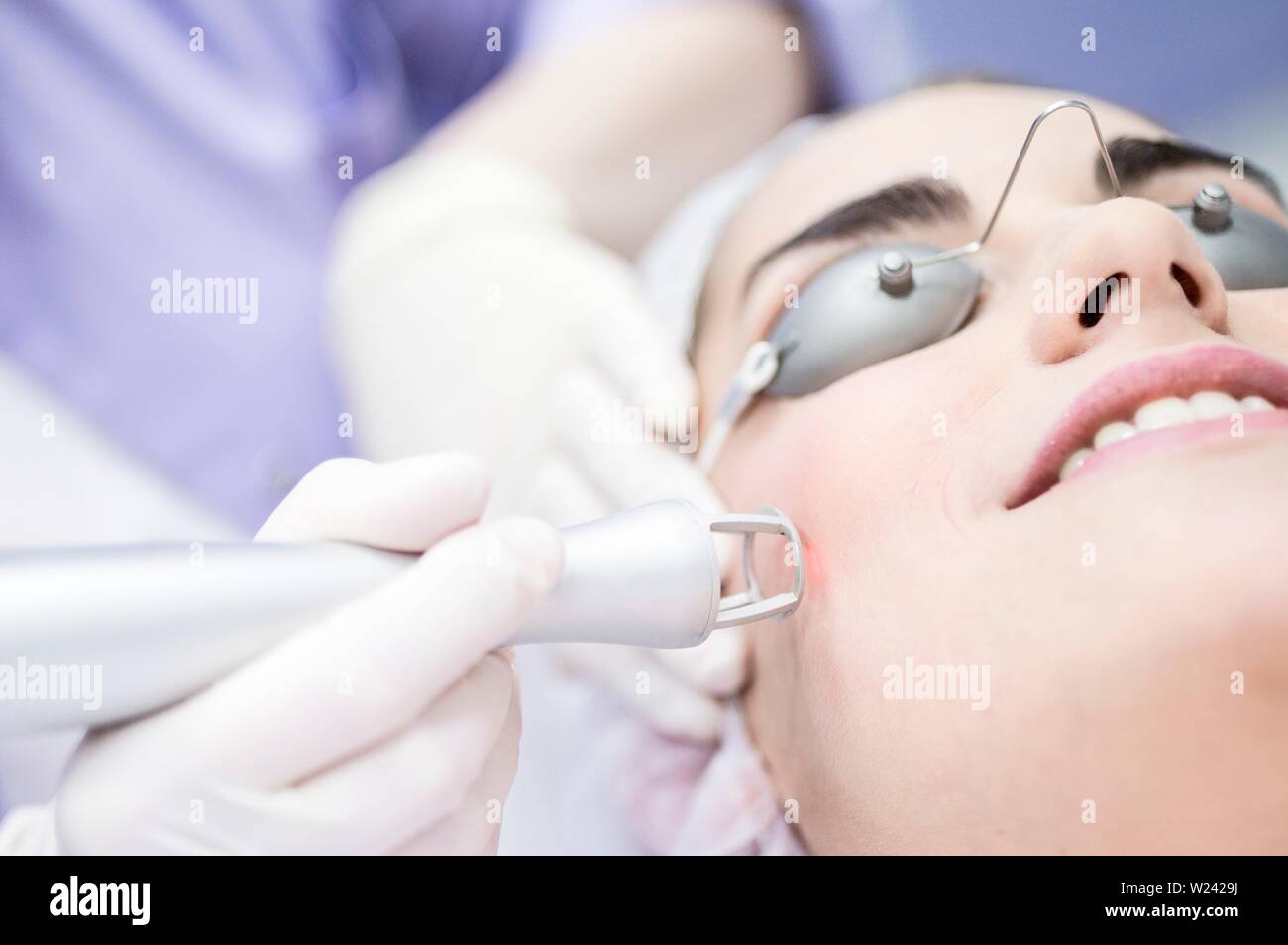 Dermatologist using laser welder machine on woman's face, close-up ...