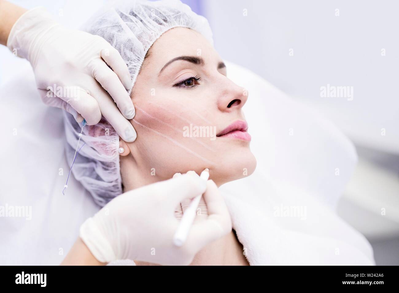 Dermatologist drawing marks on woman face for thread-lift, close-up ...