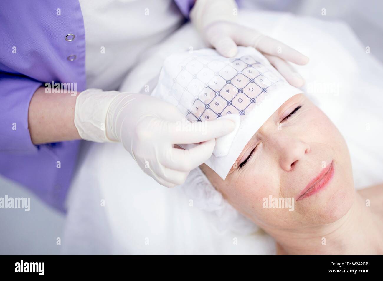 Dermatologist tracing grid paper on mature woman's forehead for ...