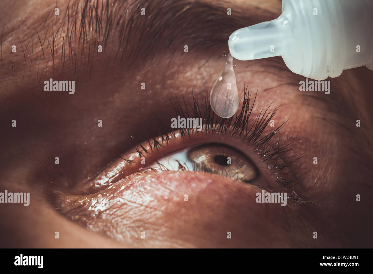 a man drips open human eye with bright red arteries drops to improve ...
