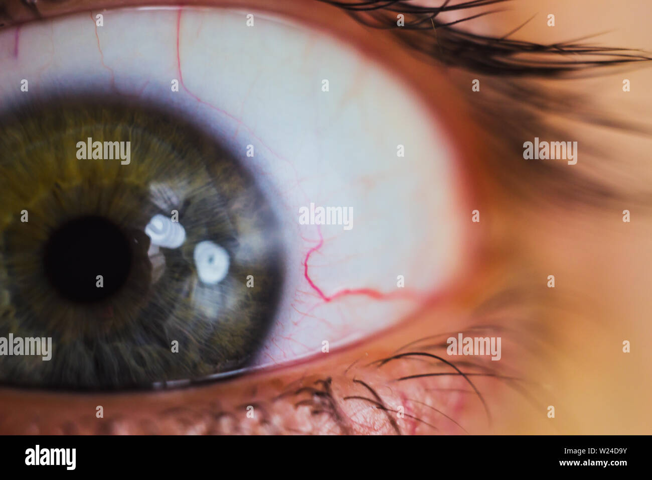wide open human eye with bright red arteries close up. irritation and ...