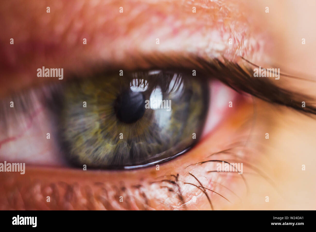 open human eye with bright red arteries close up. irritation and ...