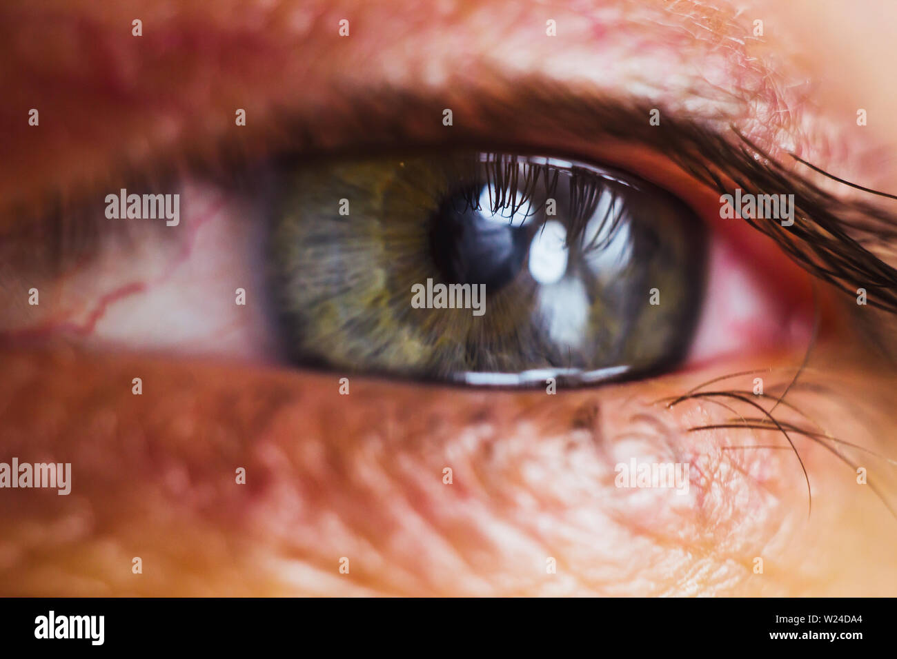 open human eye with bright red arteries close up. irritation and ...