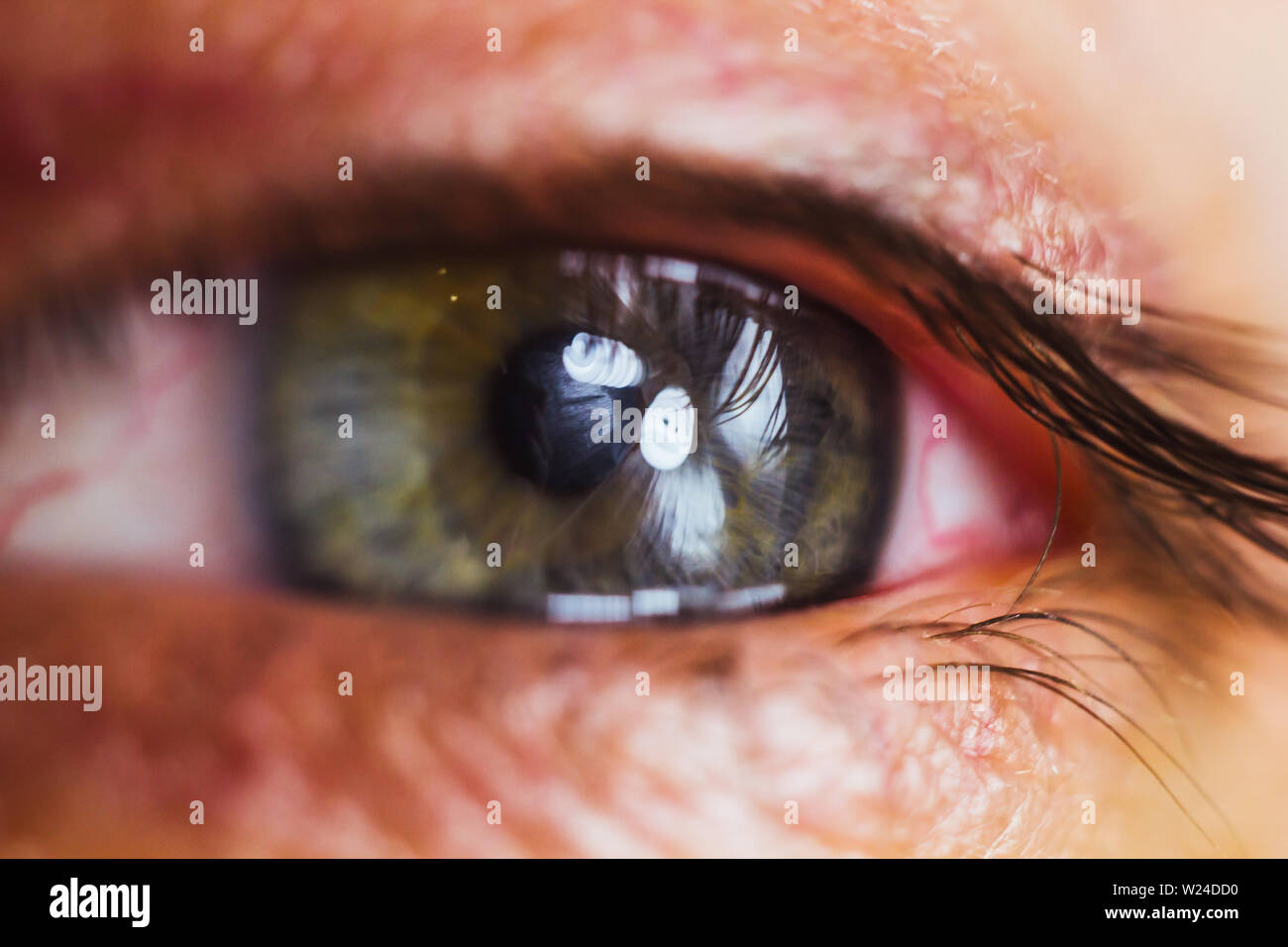 open human eye with bright red arteries close up. irritation and ...