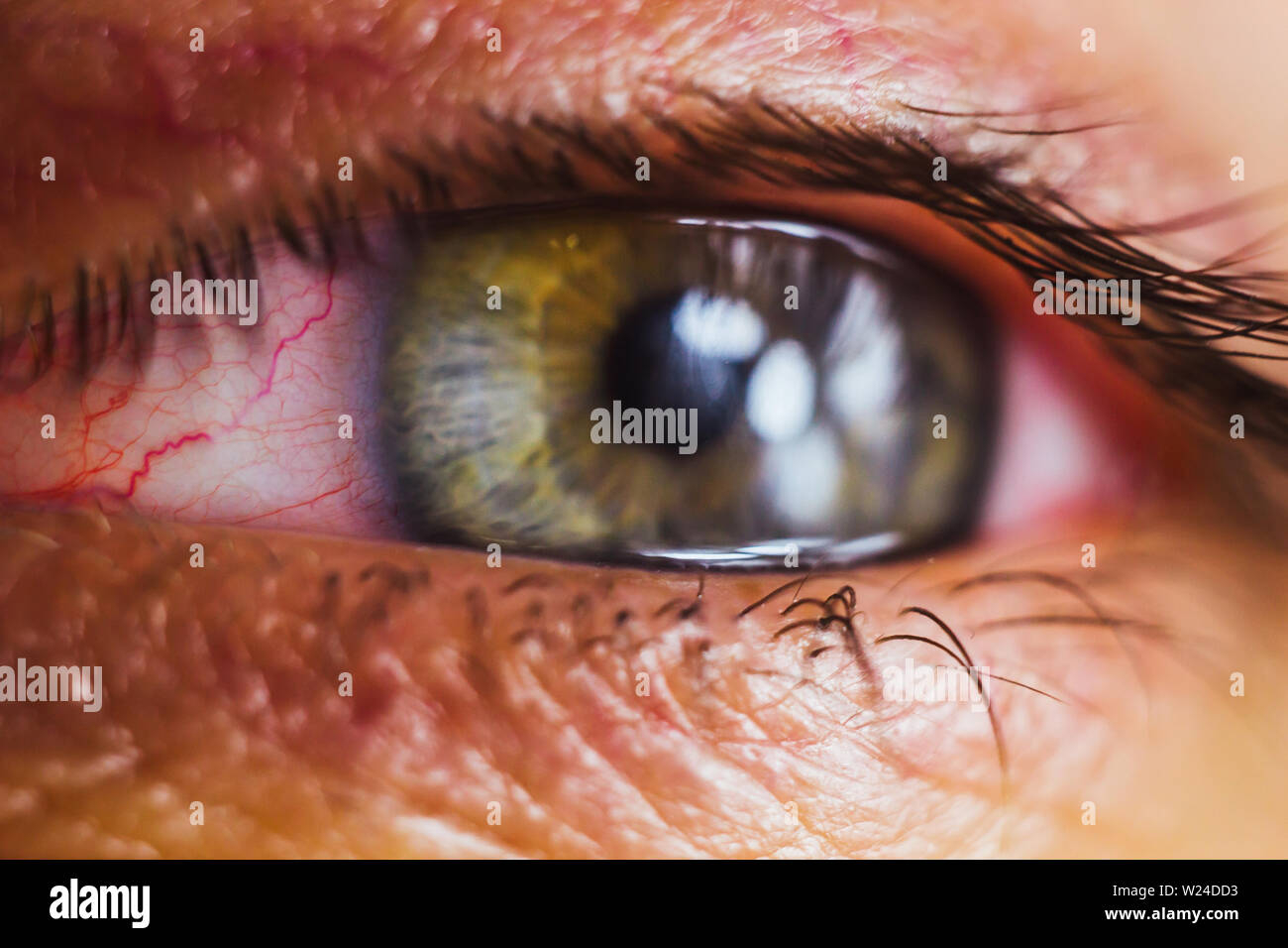 open human eye with bright red arteries close up. irritation and ...