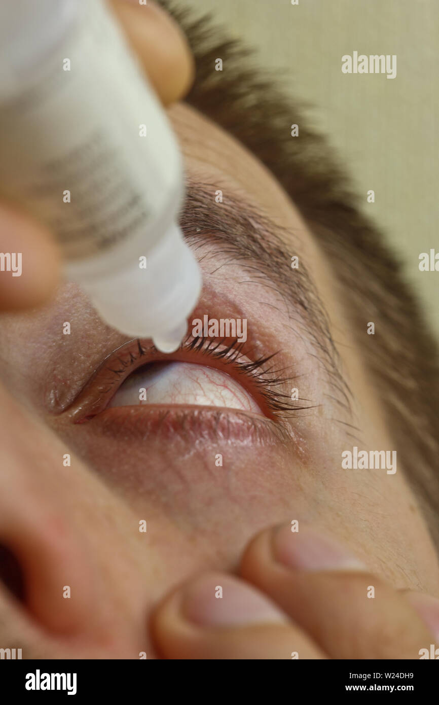 a man drips open human eye with bright red arteries drops to improve ...