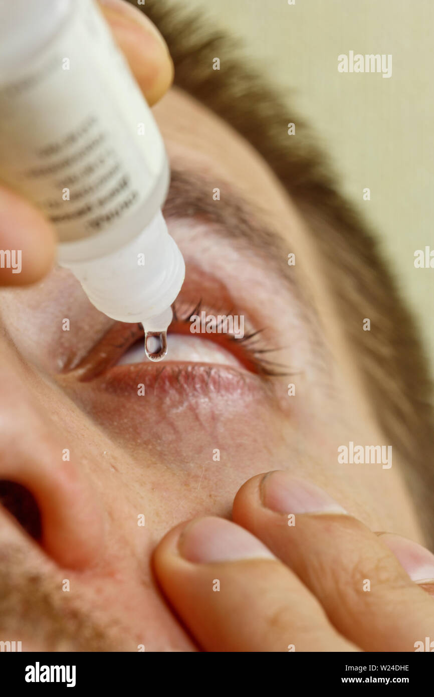 a man drips open human eye with bright red arteries drops to improve ...