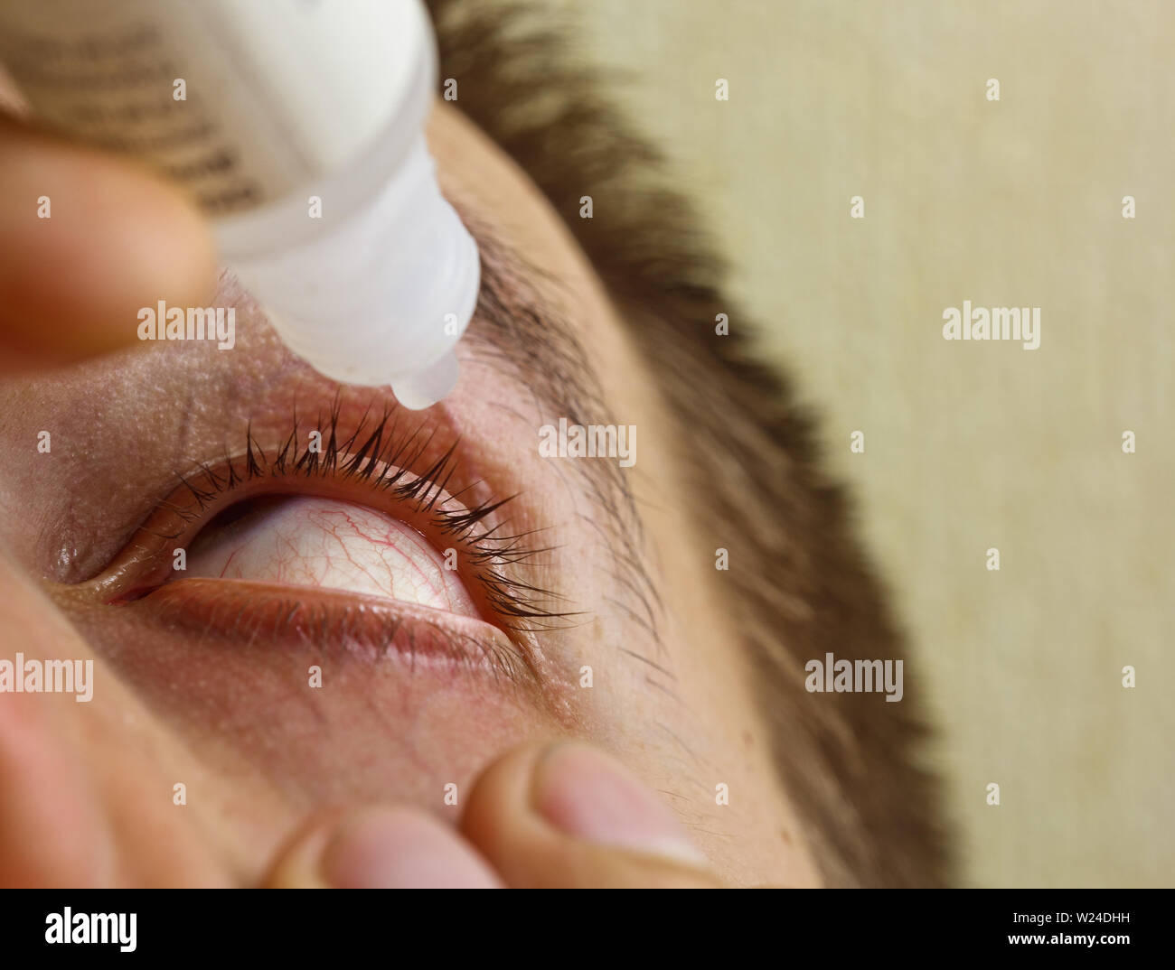 a man drips open human eye with bright red arteries drops to improve ...