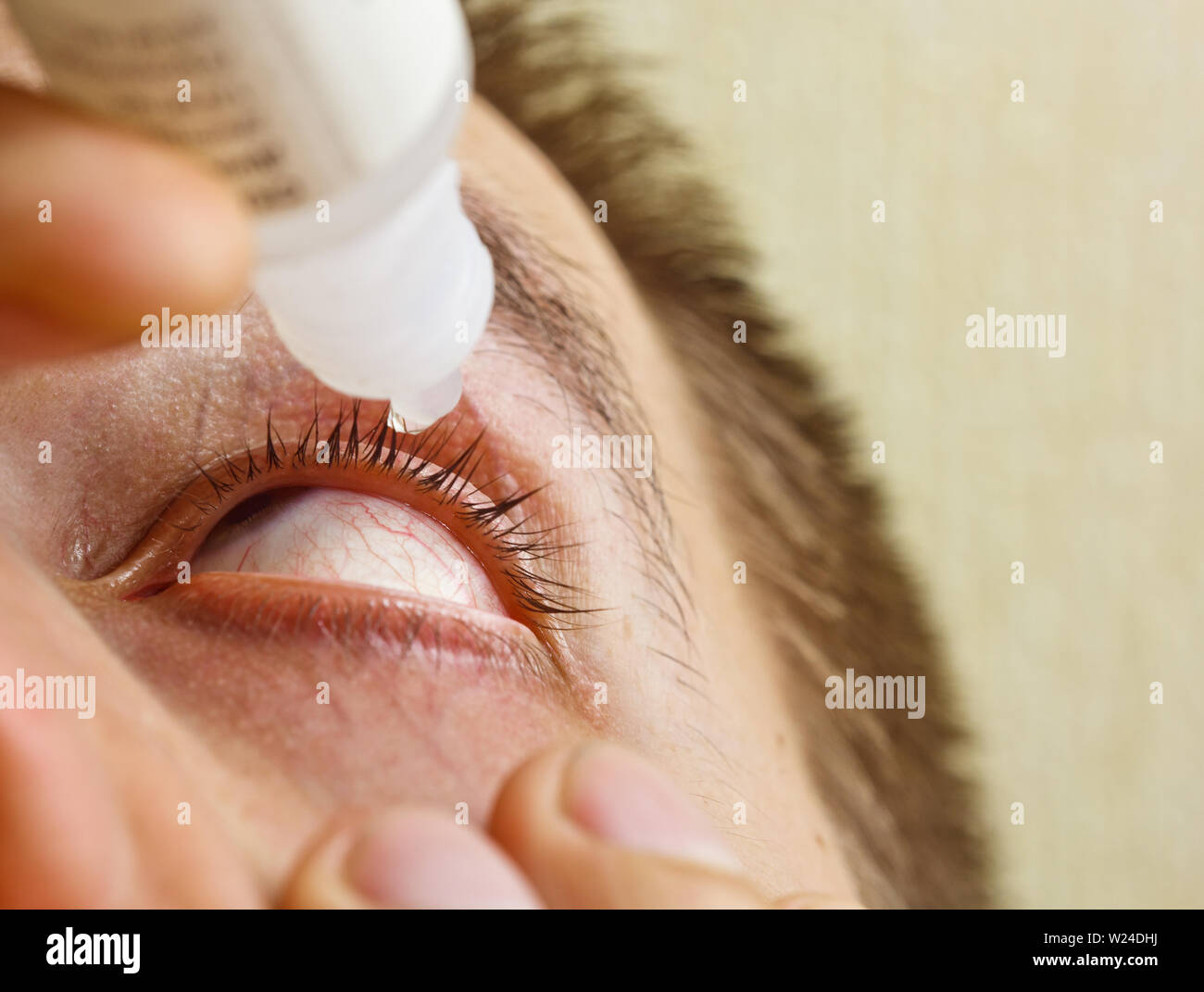 a man drips open human eye with bright red arteries drops to improve ...