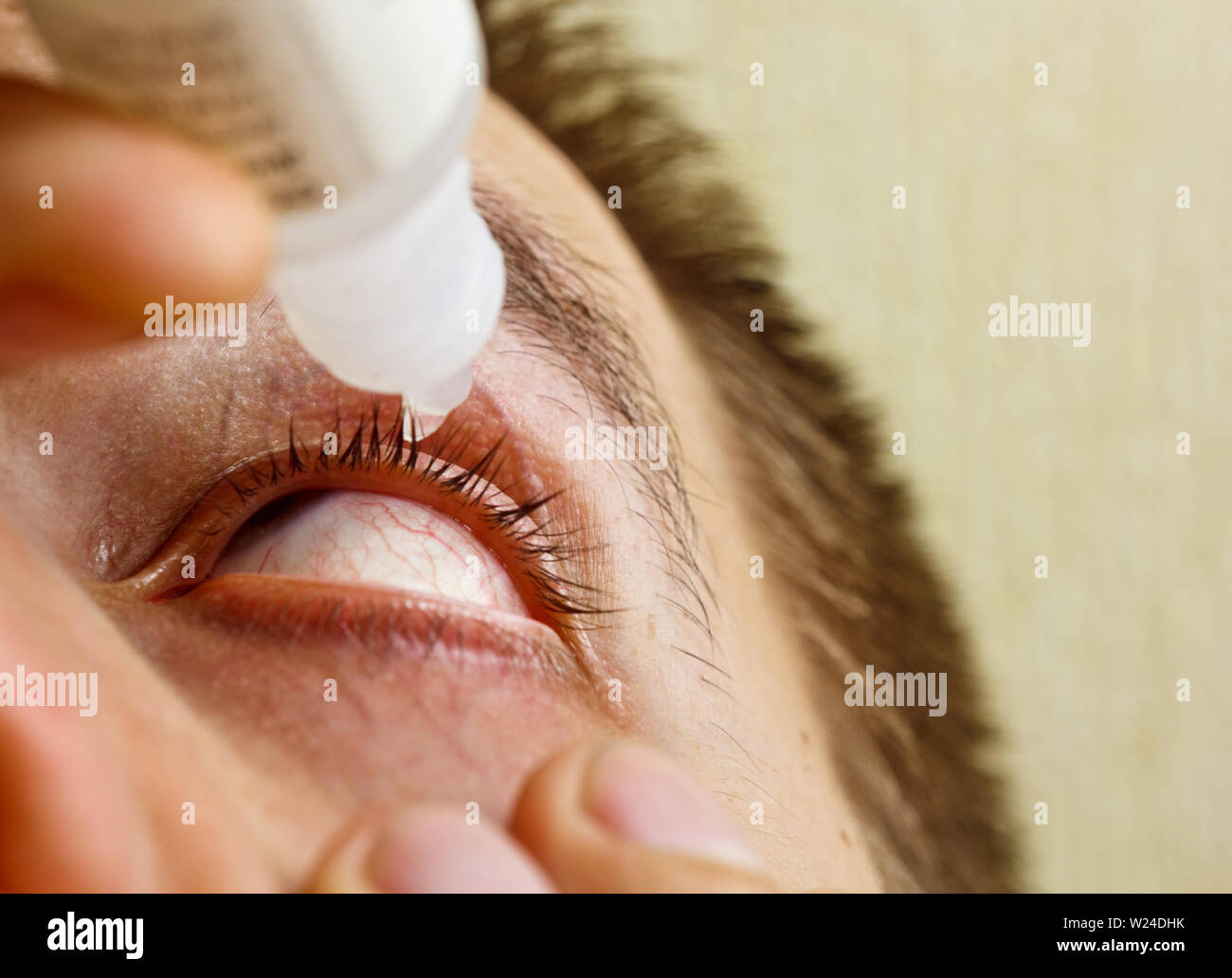 a man drips open human eye with bright red arteries drops to improve ...