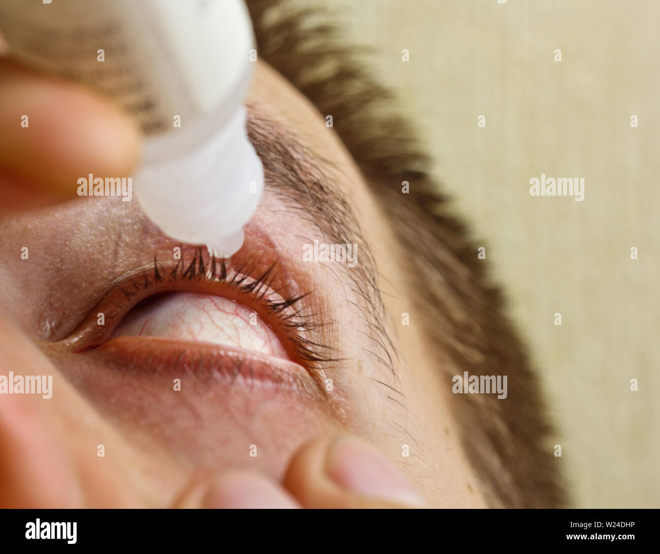 Eyelid with blood vessels veins hi-res stock photography and images - Alamy