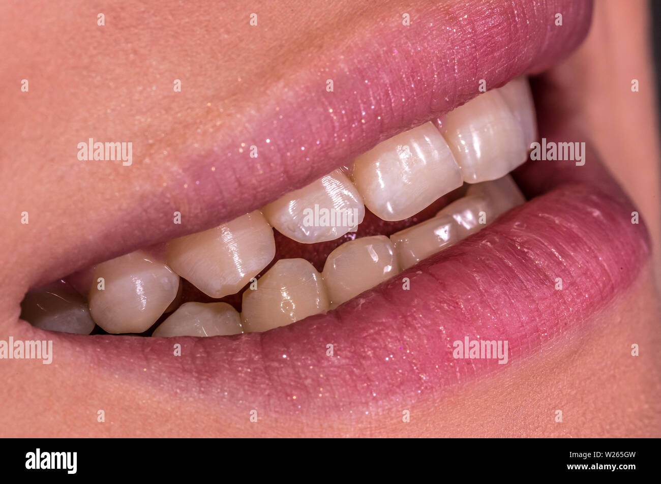 Woman smile with great natural teeth Stock Photo - Alamy