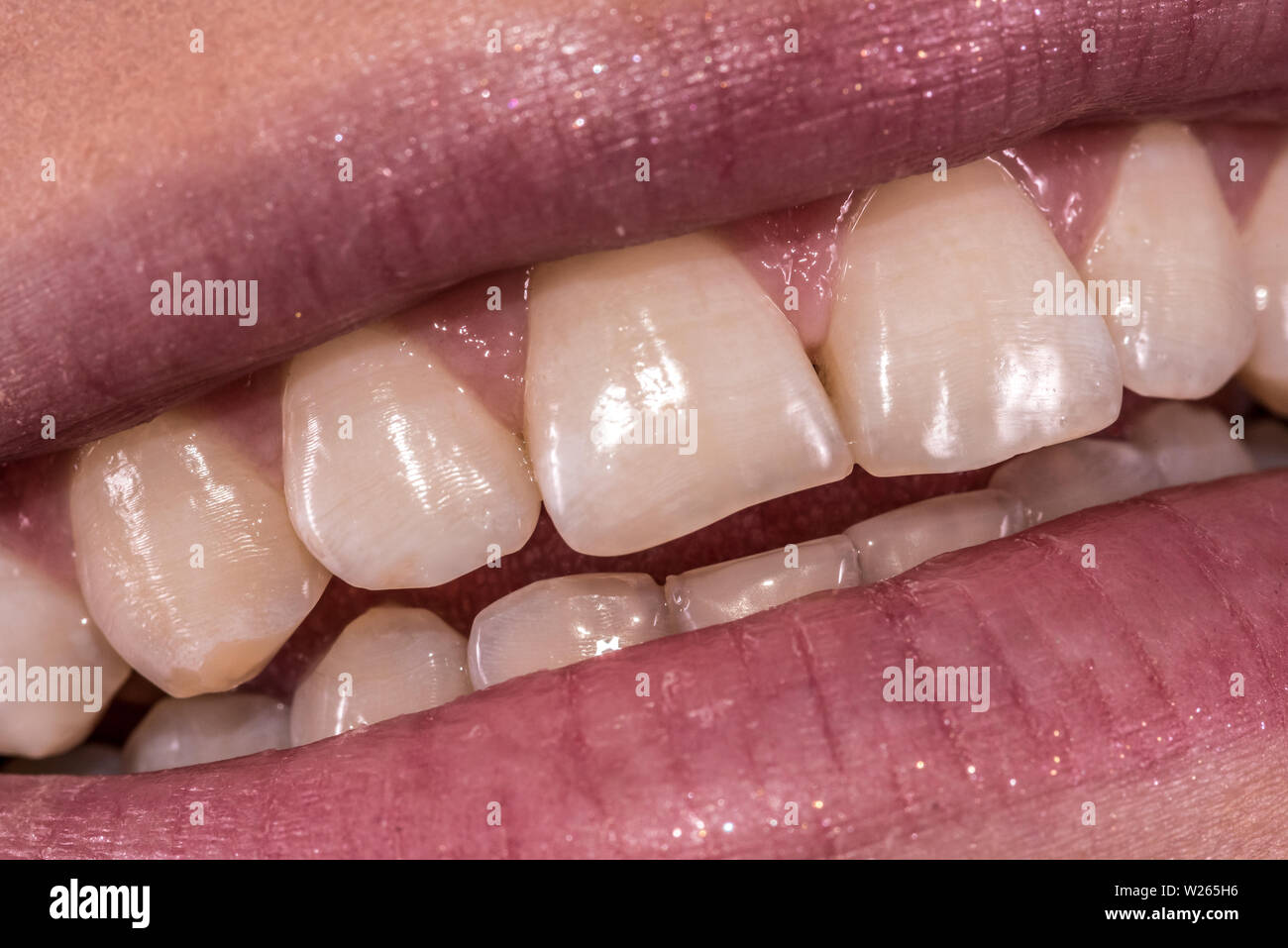 Closeup woman chewing gum hi-res stock photography and images - Alamy
