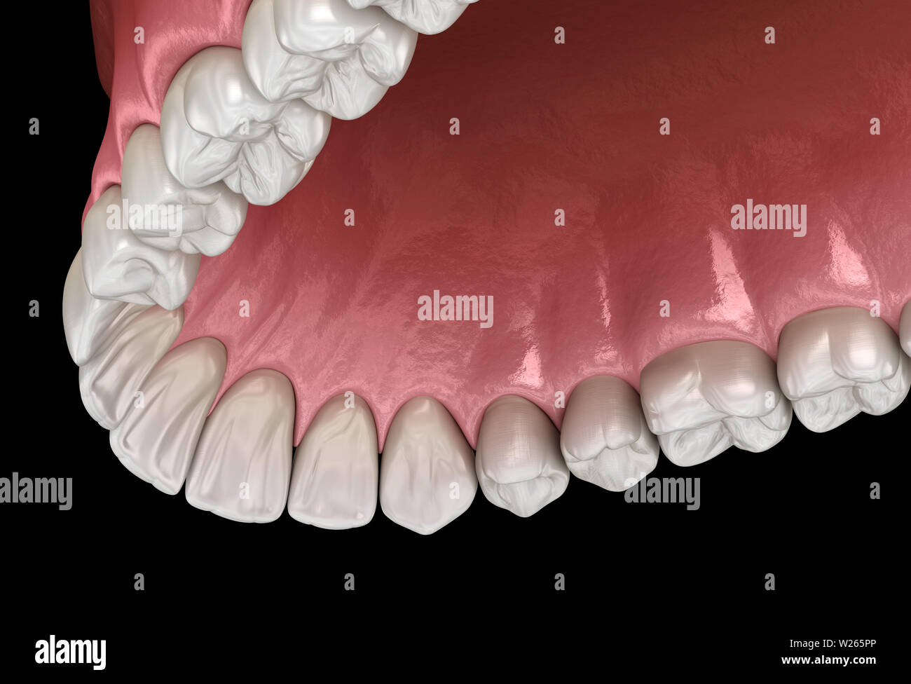 Maxillary human gum and teeth. Medically accurate tooth 3D illustration ...