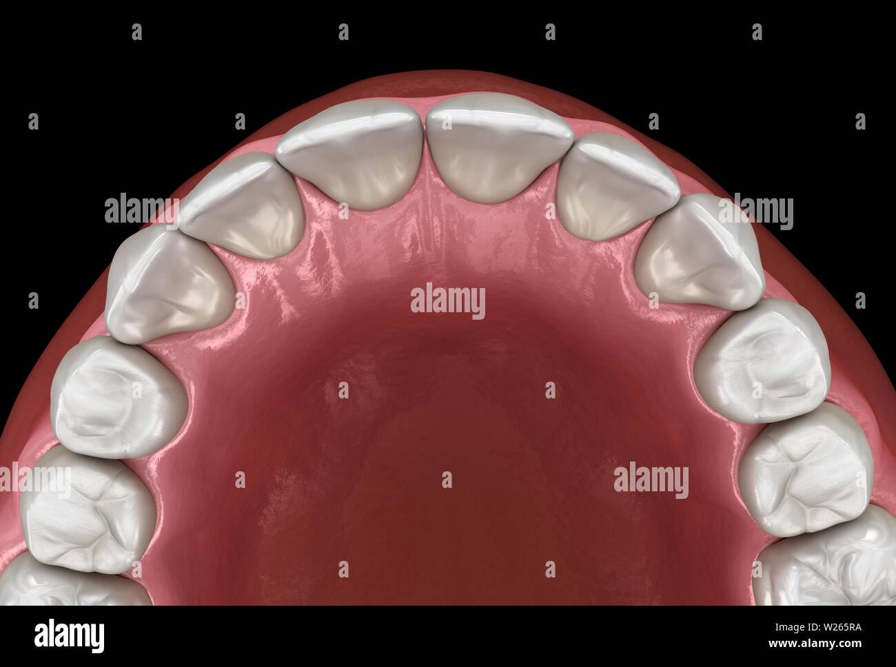 Maxillary human gum and teeth. Medically accurate tooth 3D illustration ...