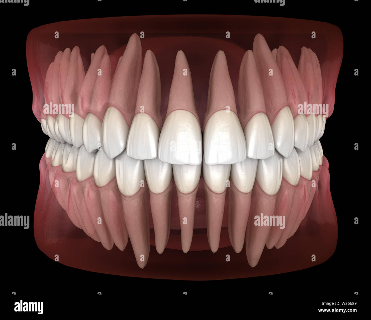 Morphology of mandibular and maxillary human gum and teeth. Medically ...