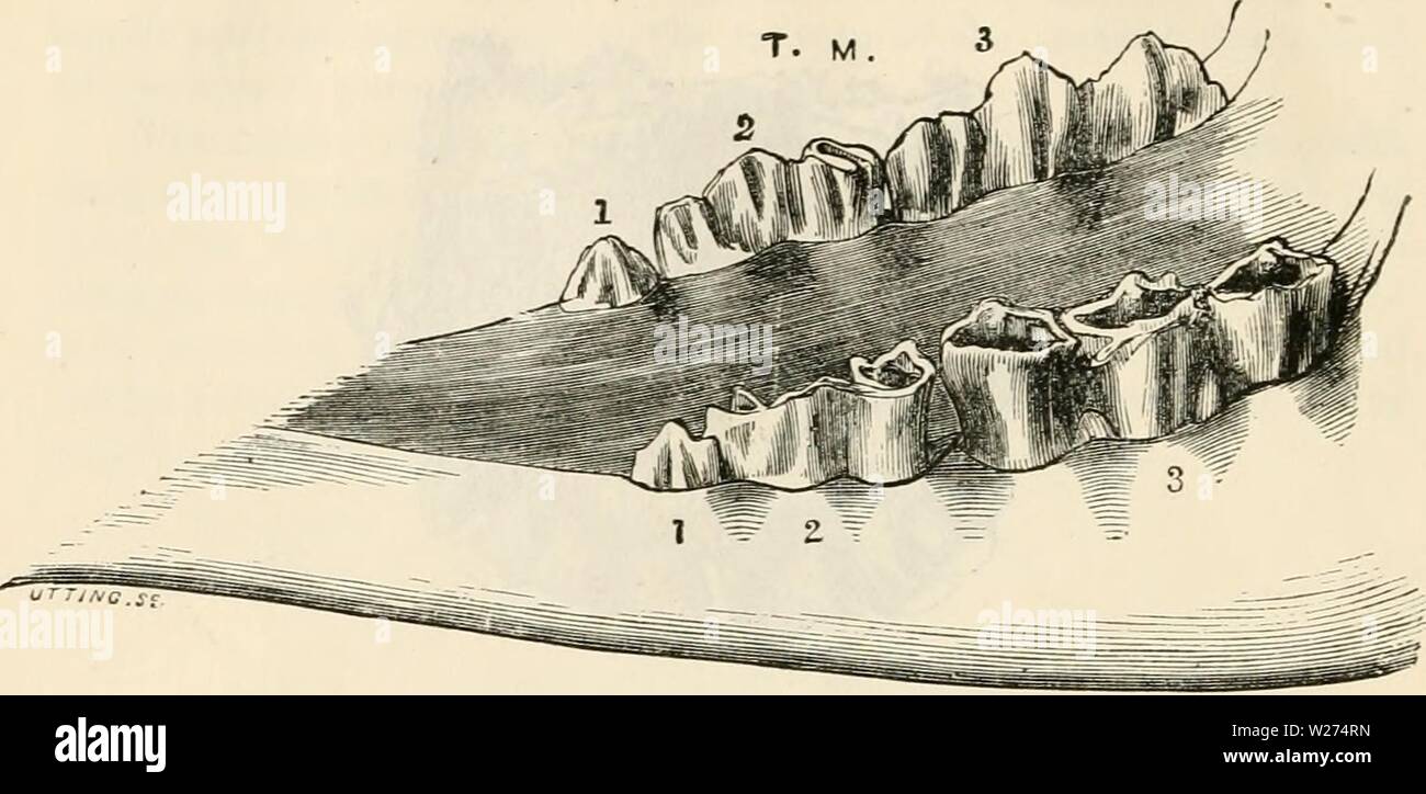 Temporary teeth hi-res stock photography and images - Alamy