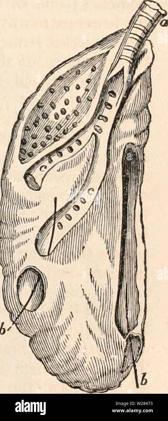 Femoral arteries hi-res stock photography and images - Alamy