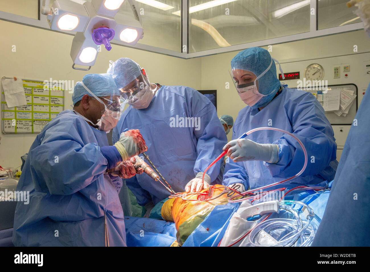 Surgeon and nurses perform a Hip Operation in an NHS Hospital Stock ...