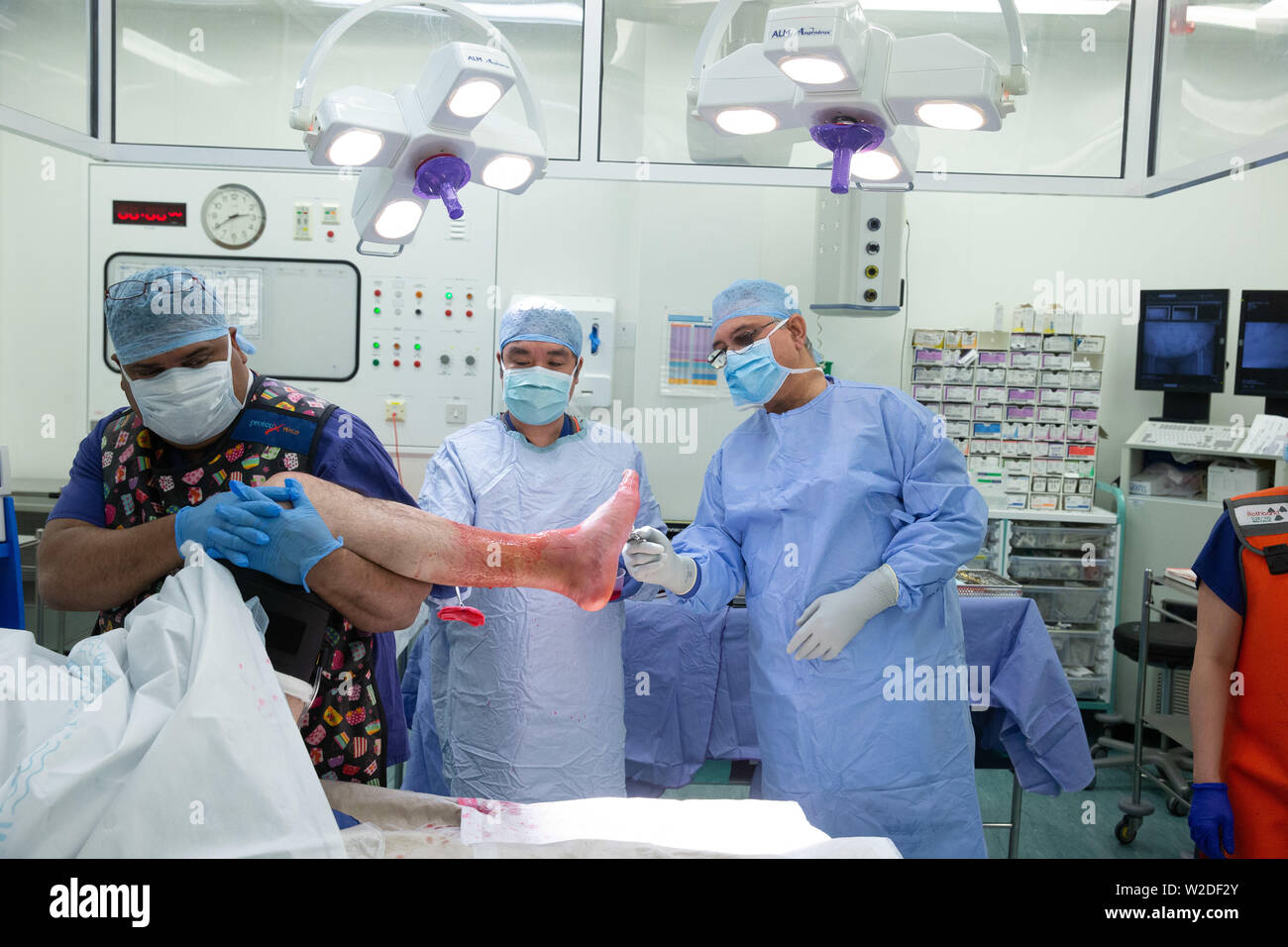 Hospital nurses prepare a patient for an ankle operation in an NHS ...