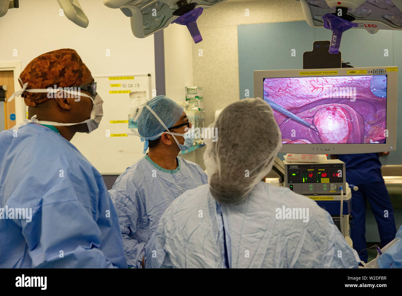 Two surgeons and a nurse study the monitor during Laparascopic surgery ...