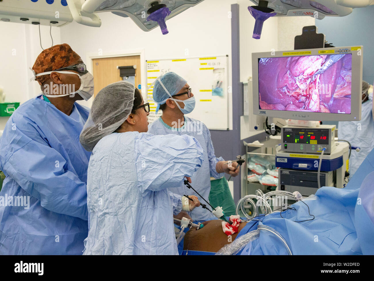 Keyhole surgery hi-res stock photography and images - Alamy